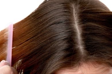 Comment différencier une lente d’une pellicule ? | VICHY