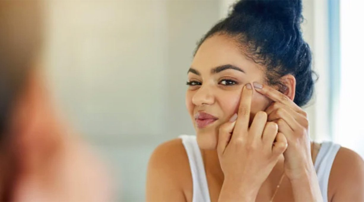 30, 40, 50 ans : d'où viennent les boutons sur le visage | VICHY