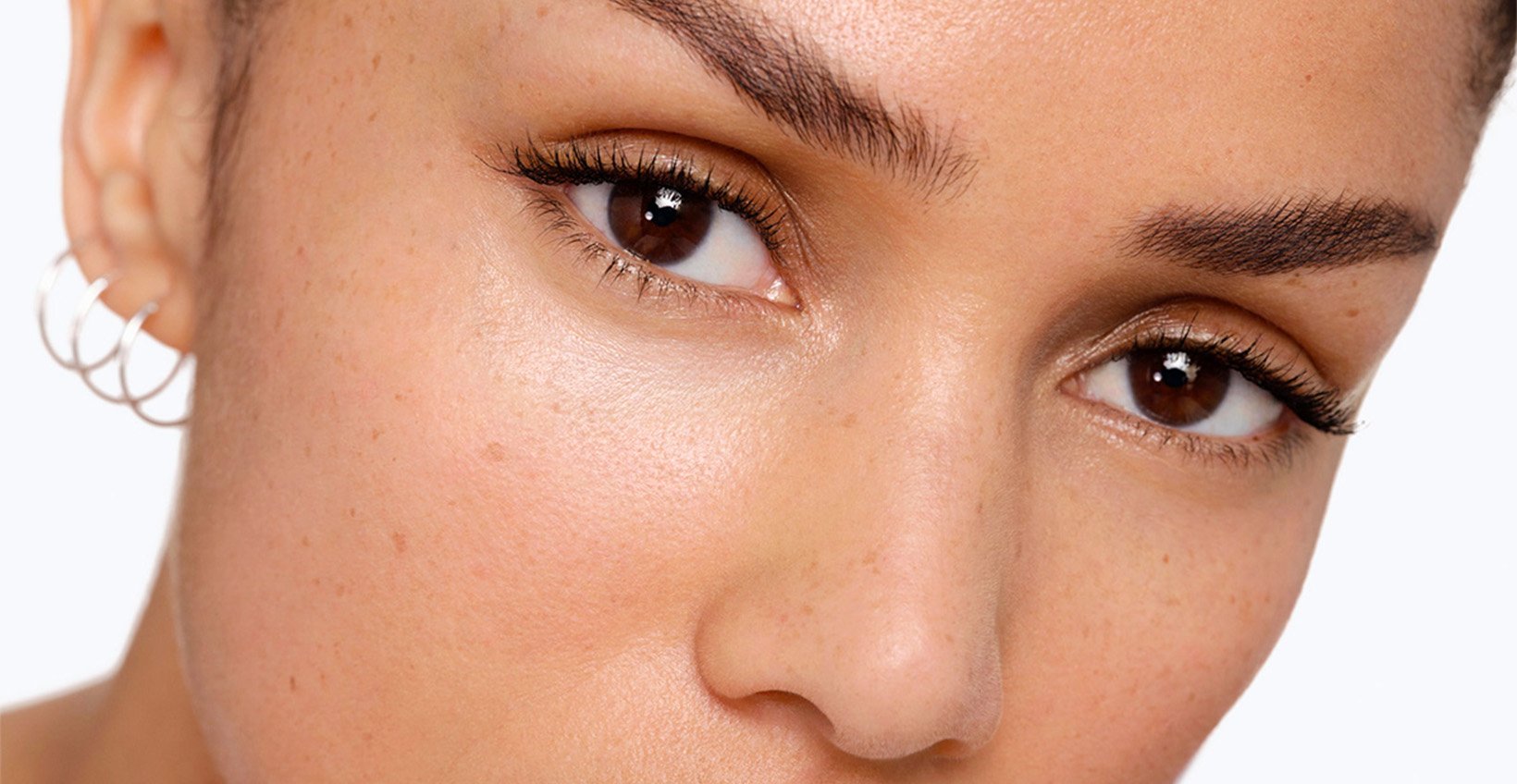 Hyperpigmentation : causes, prévention et soins | VICHY